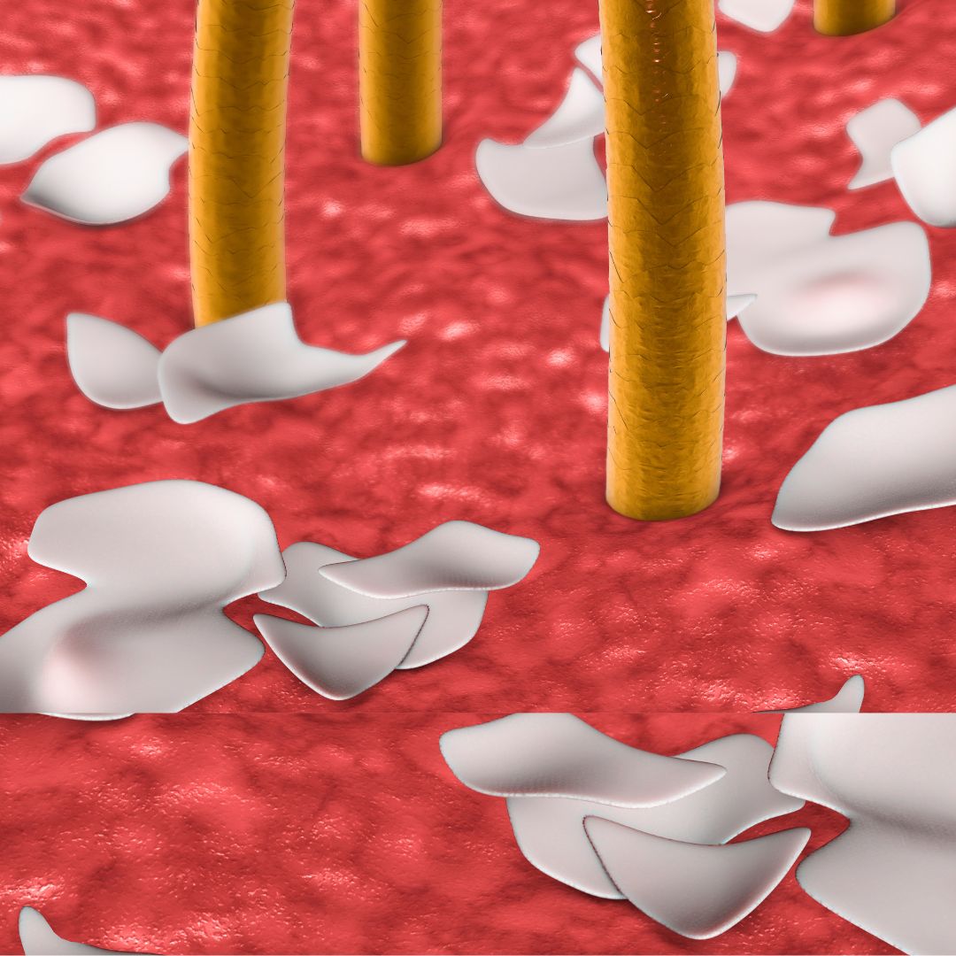 Your Guide To Identify and Treat Various Scalp Conditions — AYANAE